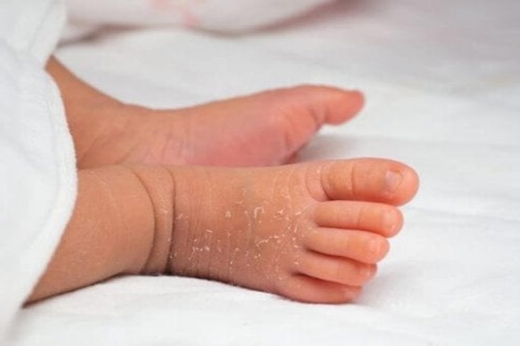 Atopik Dermatit Belirtileri Nelerdir? - Güncel Oku