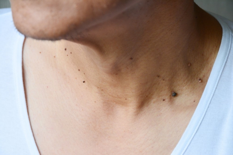 Boyundaki Ben Polisliğe Engel Mi? - Güncel Oku