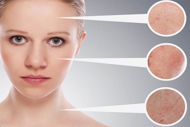 Dermatop Krem Nerelerde Kullanılır? - Güncel Oku