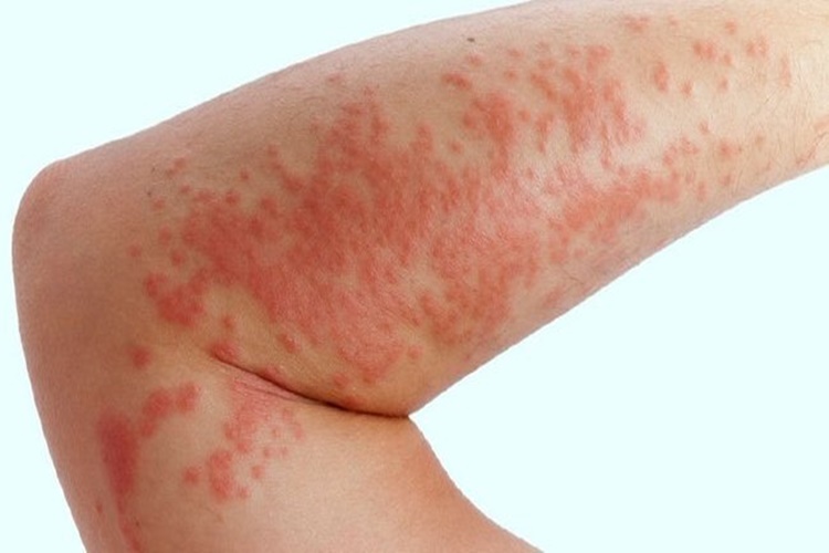 Egzamaya Domuz Yağı Sürülür Mü? - Güncel Oku