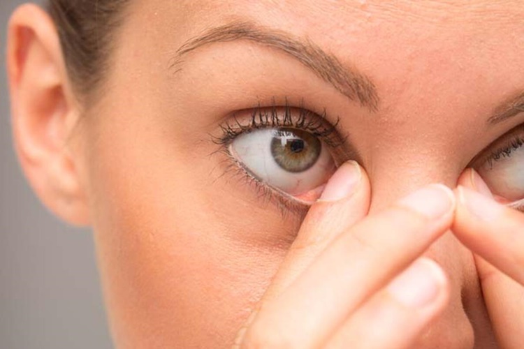 Gözde Yanma ve Çapaklanma Sebebi Nedir? - Güncel Oku