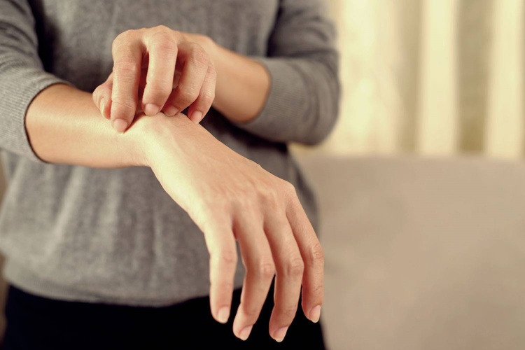 Hamam Böceği Kaşıntı Yapar Mı? - Güncel Oku