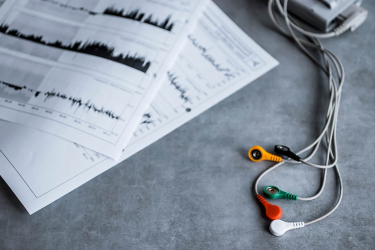 Holter Cihazı Nasıl Çalıştırılır? - Güncel Oku