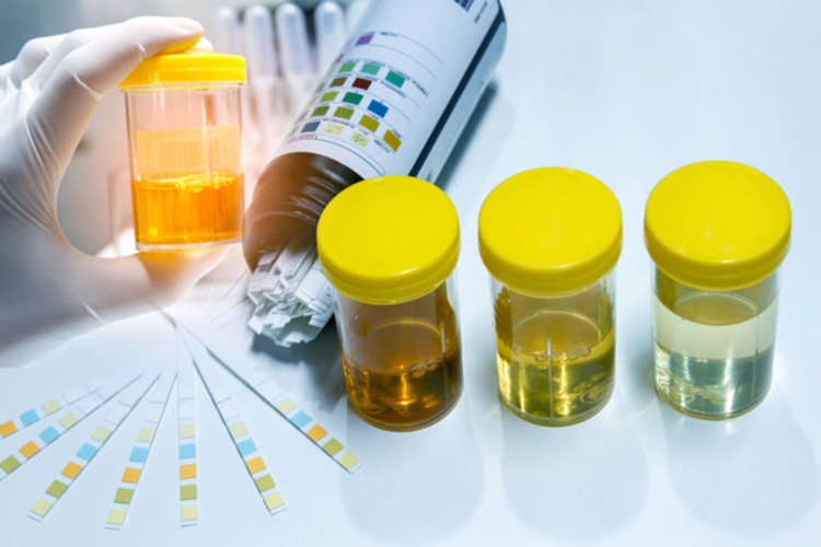 İdrar Yolu Enfeksiyonu Tedavisi - Güncel Oku