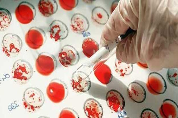 Kan Grubu Testi Nasıl Yapılır? - Güncel Oku