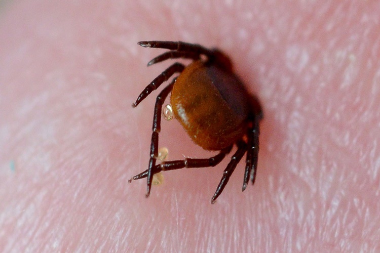 Kene Isırması Belirtileri Kaç Saatte Belli Olur? - Güncel Oku