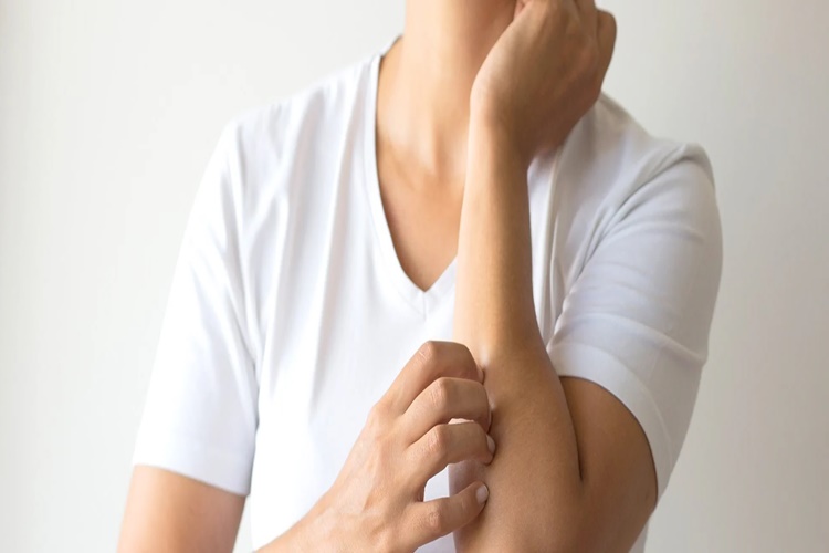 Kepek Kaşıntı Yapar Mı? - Güncel Oku