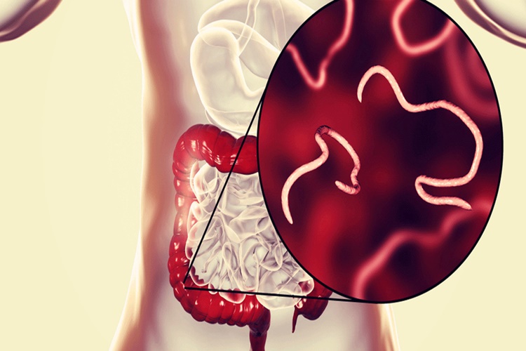 Kıl Kurdu Cinsel Yolla Bulaşır Mı? - Güncel Oku