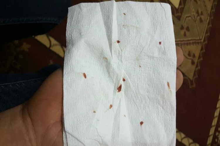 Makatta Kaka Kalması Abdesti Bozar Mı? - Güncel Oku