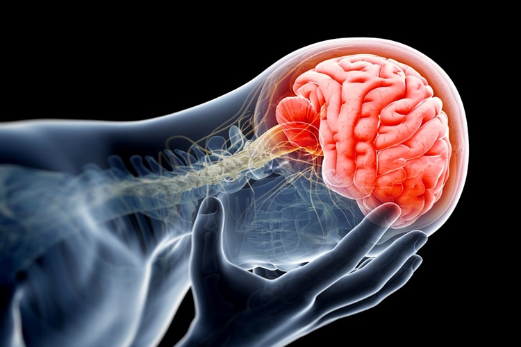 Migren İle İlgili Merak Edilen Sorular - Güncel Oku