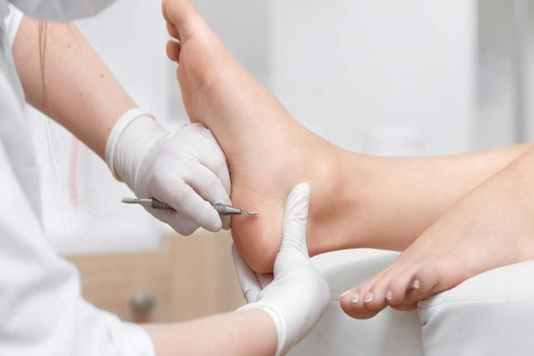 Nasır Ameliyatı Kesin Çözüm Mü? - Güncel Oku