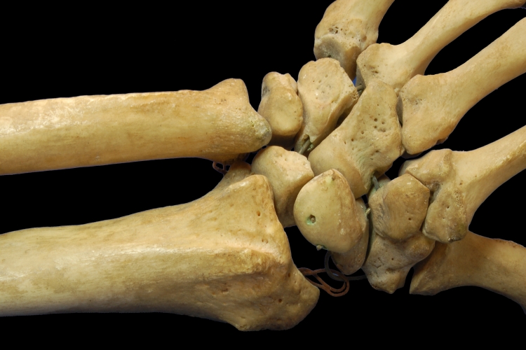 Ölen İnsan Kaç Yılda Çürür? - Güncel Oku