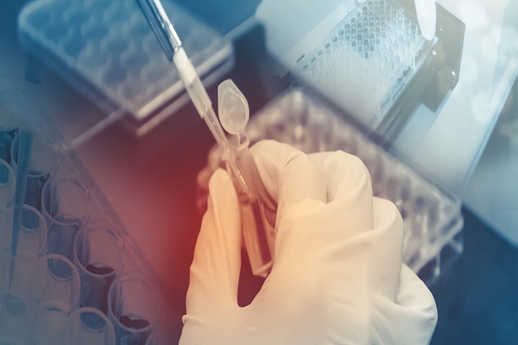 Ölüden DNA Testi Nasıl Yapılır? - Güncel Oku