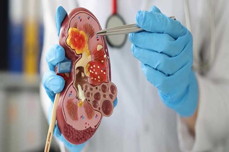 Oneptus Böbreklere Zarar Verir Mi? - Güncel Oku