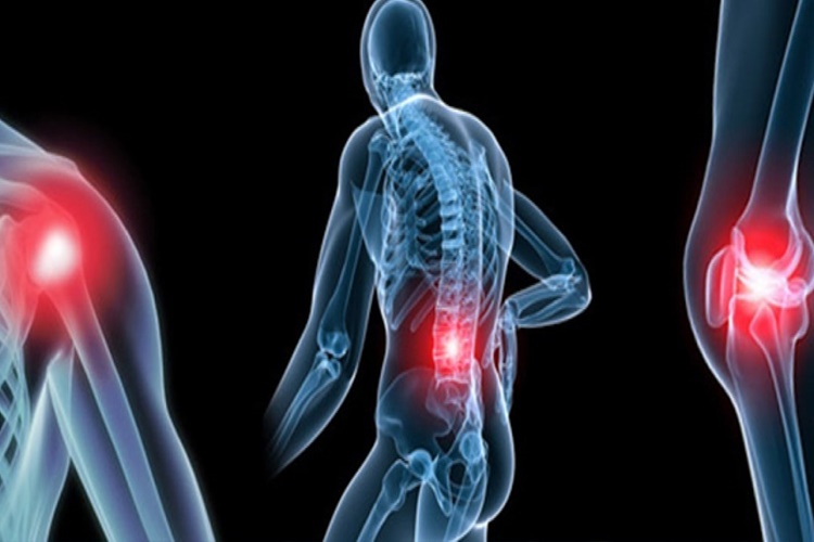 Osteoxondroz Nasıl Tedavi Edilir? - Güncel Oku