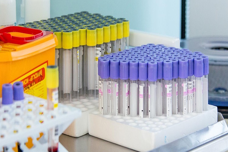 Östrojen Hormonu Testi Nasıl Yapılır? - Güncel Oku