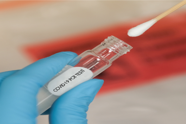 PCR Testi Nasıl Yapılır? - Güncel Oku