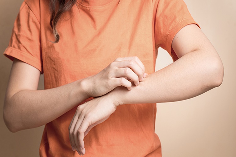 Roaccutane Kaşıntı Yapar Mı? - Güncel Oku