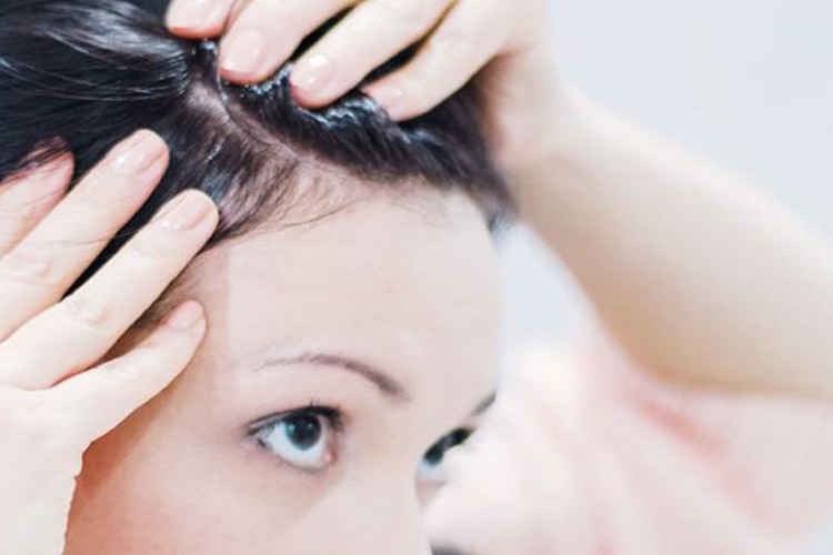 Saç Kökü Ağrısı Nasıl Geçer? - Güncel Oku