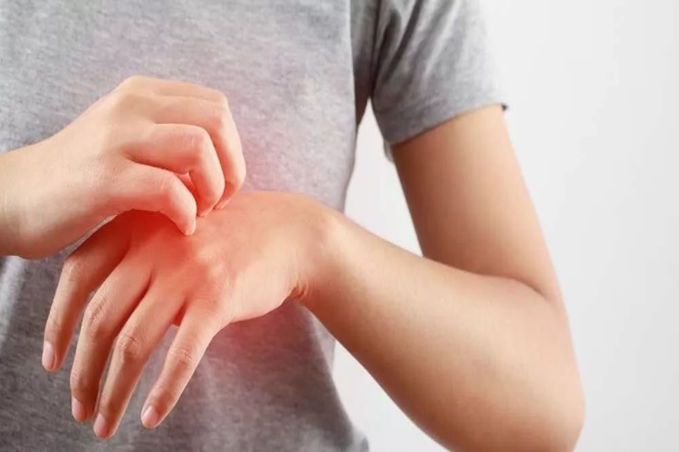 Şeker Hastalığı Kaşıntı Yapar Mı? - Güncel Oku