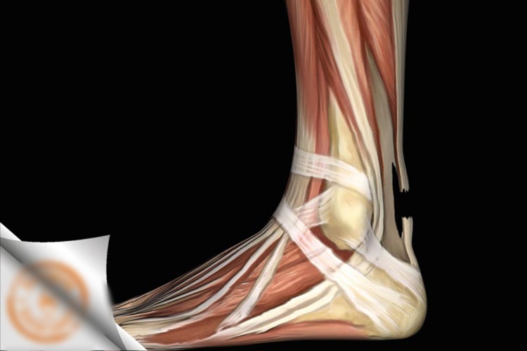 Tendon Ağrısı Nasıl Geçer? - Güncel Oku