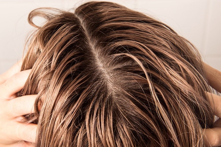 Yağlı Saçlar Çabuk Uzar Mı? - Güncel Oku